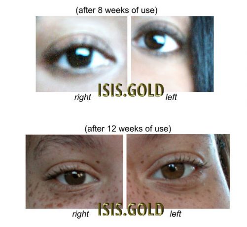 IRIS WHITENER EYE DROPS - ISIS.GOLD