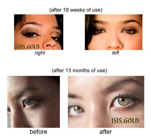 IRIS WHITENER EYE DROPS - ISIS.GOLD