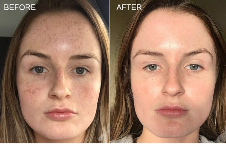 TCA 100% - ISIS.GOLD